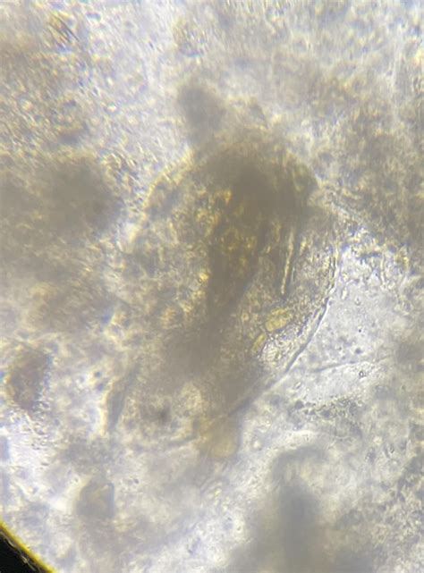 Ova Structures Images From Stool Sample Findings Grouped By Linear Interior Structures Im