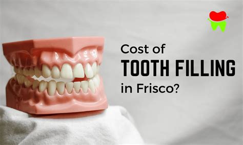 Teeth Filling Cost In Frisco Affordable Dental Care