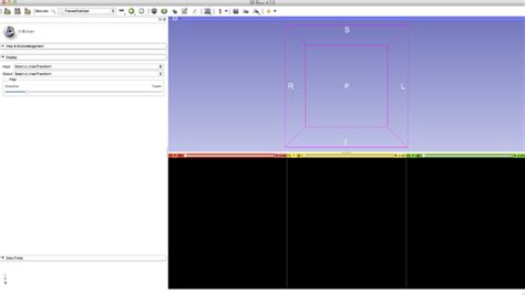 Documentation Nightly Modules TrackerStabilizer Slicer Wiki