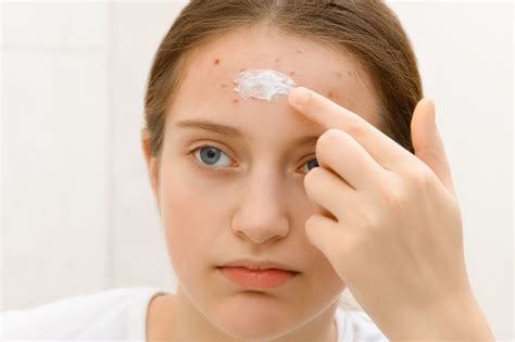 소녀는 그녀의 얼굴에 크림을 두고 여드름을 가진 십대 소녀의 얼굴 피부에 여드름 그녀는 거울에 자신을 보고 아름다움과 건강의
