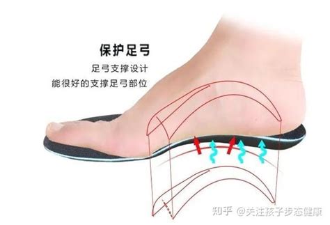矫正鞋垫到底有多厉害，满满的都是科技 知乎