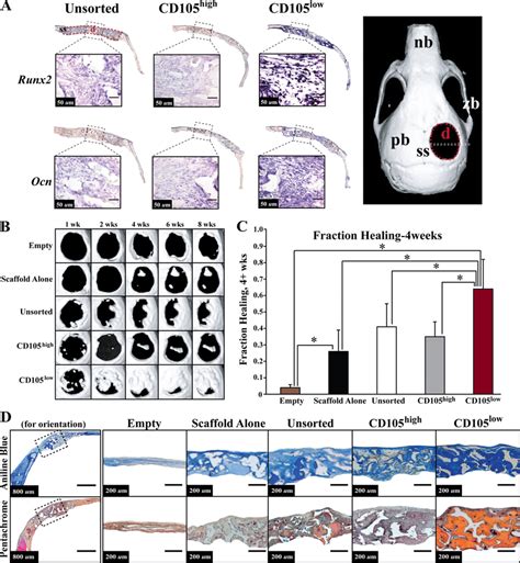 Osteogenic Gene Expression In Vivo And Healing Of A Critical Sized 4 Mm