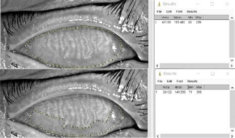 the semi automated imagej tool is used to draw the borders of the total