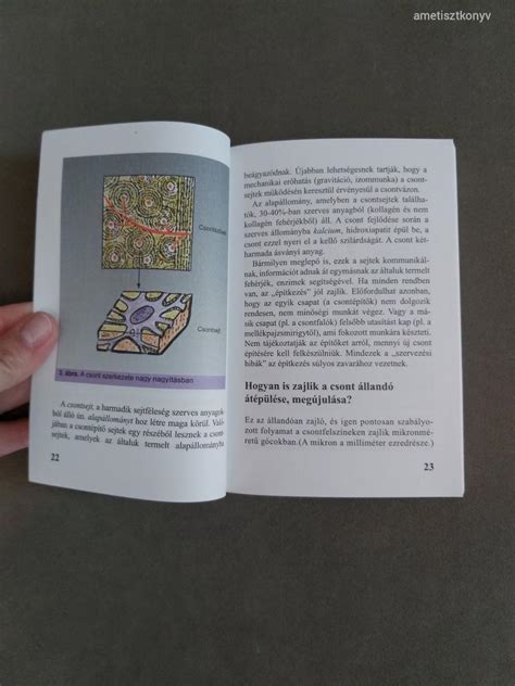 Dr Tamási László Reumatológia Oszteoporózis A Csontritkulás Megelőzése és Kezelése