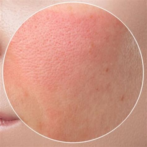 Willcome Orthopaedic Padding Bandage For Sale