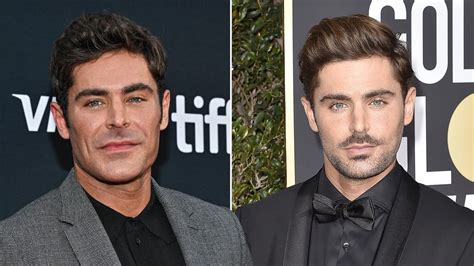 Zac Efron E I Dettagli Del Terribile Incidente Domestico Che Gli Ha