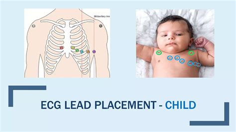 Basics Of Paediatric Ecg Pptx