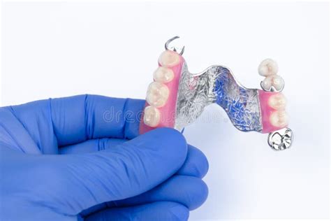 Prothèses Dentaires Dentisterie Orthopédique Prothèses Dentaires