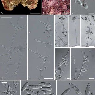 Cladobotryum Protrusum AE Conidiophores With Clusters Of Conidia F Download Scientific