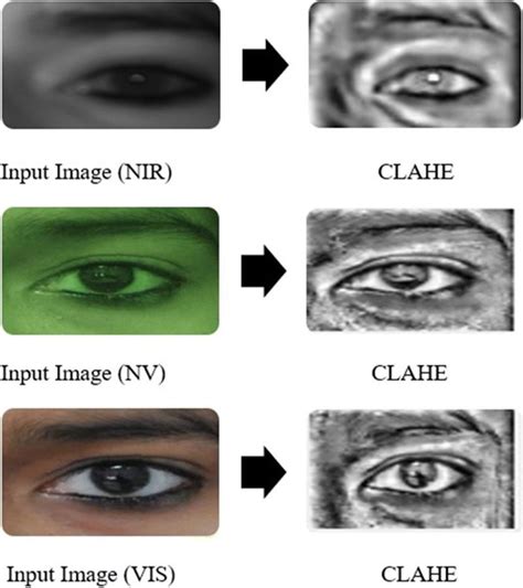 Pre Processed Input Image After Applying Clahe Download Scientific