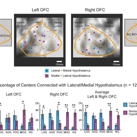 A The Lateral And Medial Parts Of The Orbital Surface That Were Download Scientific Diagram