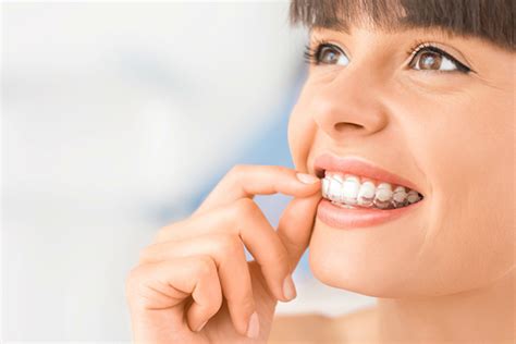 California MD Invisalign Three Notch Dental
