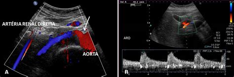 Manual De Doppler Radiologia Online