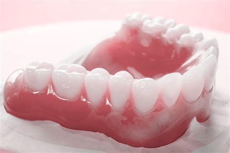 Дентален бондинг: цена, изграждане, поддръжка | Medical Dent