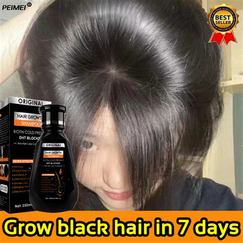 Hair Growth Ginger Shampoo Anti Hair Loss Shampoo Prevent Hair Loss
