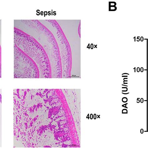Sepsis Suppresses Intestinal Epithelial Cell Proliferation And Induces