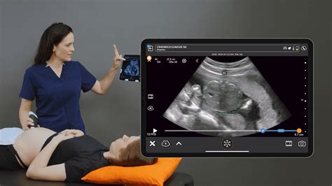 Fetal Abdominal Circumference Clarius