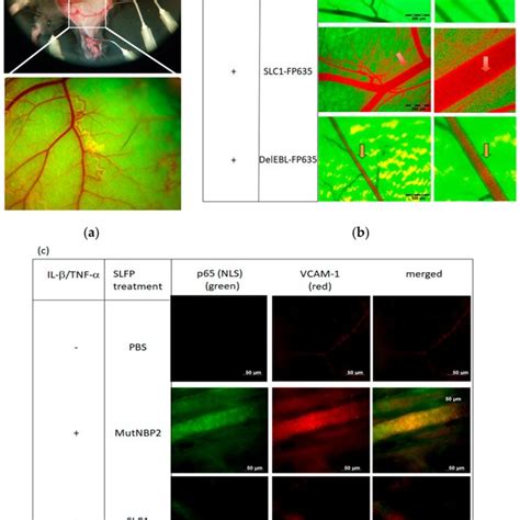 Role Of Nf Kappab In Ms Macrophagesmigroglia Th Cells B Cells