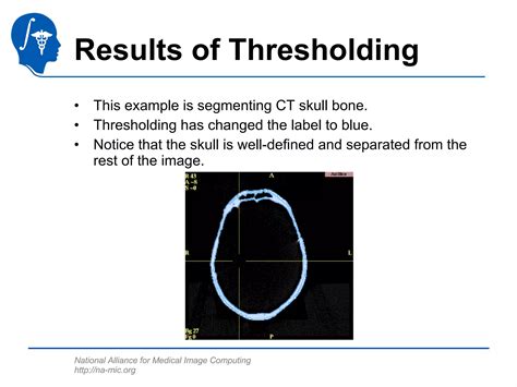 Manual Segmentation 3747 Ppt
