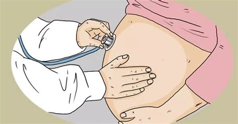 生孩子選順產好還是剖腹產好？聽說剖腹產傷口易增生，是真的嗎？