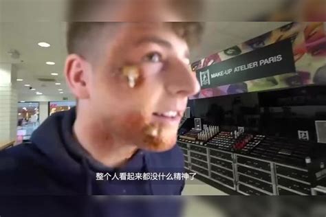 小伙脸部溃烂一心想求弟弟安慰岂料弟弟根本不搭理
