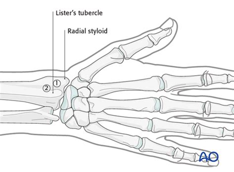 Landmarks Of The Wrist And Hand Flashcards Quizlet