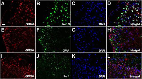 Double Immunofluorescence Staining Performed With Y 17 Anti Gpr40
