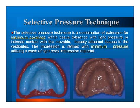 Complete Dentures 7 Final Impressions Pdf