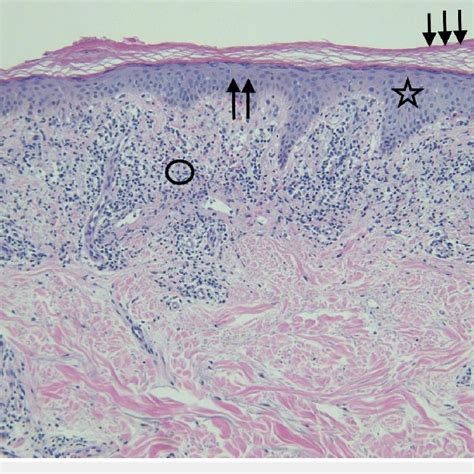 Distant View Of The Microscopic Examination Of Testosteroneassociated