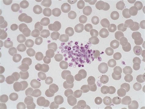 Platelet Aggregate Horiba