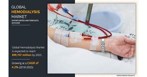 Hemodialysis Market Size Usd 99747 Mn By 2025 A Growing Industry