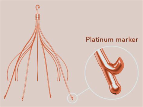 Ivc Filter Replacementremoval Northwest Radiology
