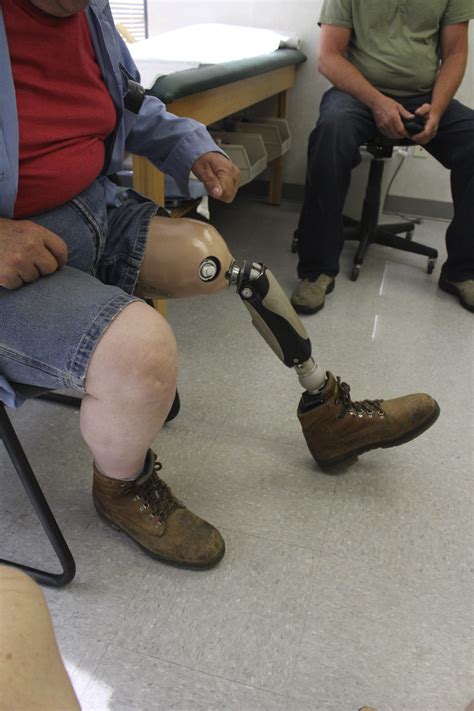 Farmer John Gets A New State Of The Art Prosthetic Leg Greenwich