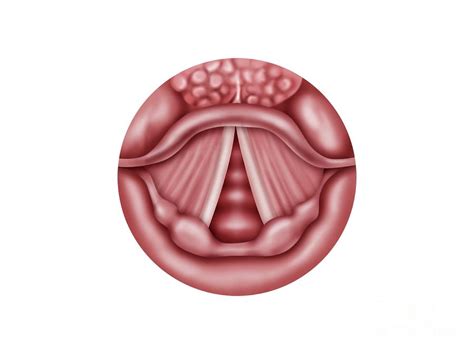 Vocal Chords Diagram