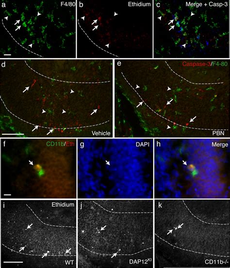 Developmental Neuronal Death In Hippocampus Requires The Microglial