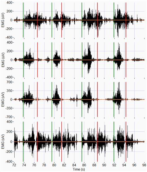 Surface Emg Signals Acquired Simultaneously From Four Muscles From Top Download Scientific