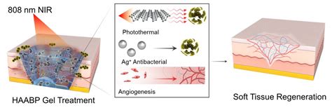 Hydrogel Injections Treat Antibiotic Resistant Infections After Hip Knee Replacements Aip