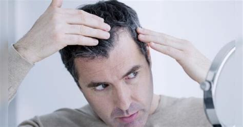 White Hair Problem Use These Home Remedies For White Hair White Balo Ko