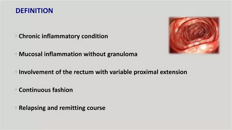 Ulcerative Colitis Management Pptx