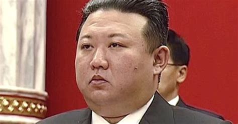 北김정은 볼에 난 뾰루지 더 커졌다
