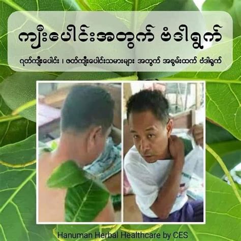 ဟန်နုမာန် တိုင်းရင်းဆေးဖြန့်ချီရေး