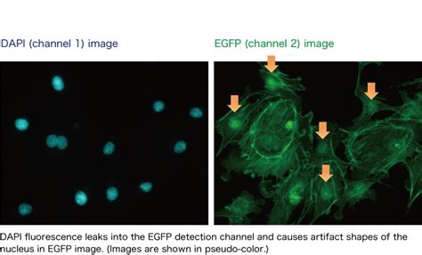 Technology Mems Confocal Unit Hamamatsu Photonics