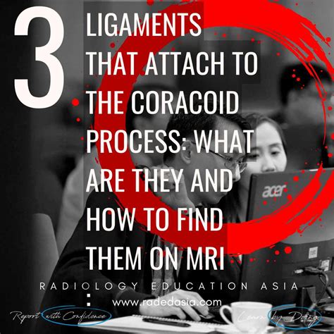 3 Ligaments Attached To The Coracoid Process What Are They And How To