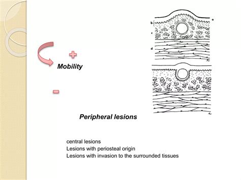 Oral Exophytic Lesions Ppt