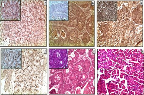 Representative Images Of Immunohistochemistry IHC Showing Expressions