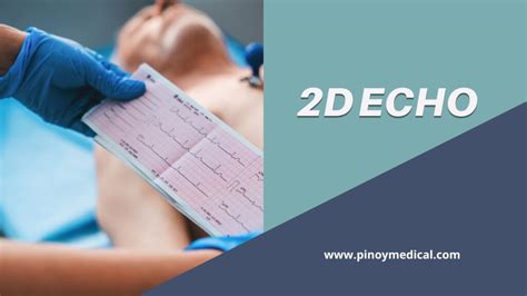 2d Echo Price In The Philippines 2025 — Pinoymedical