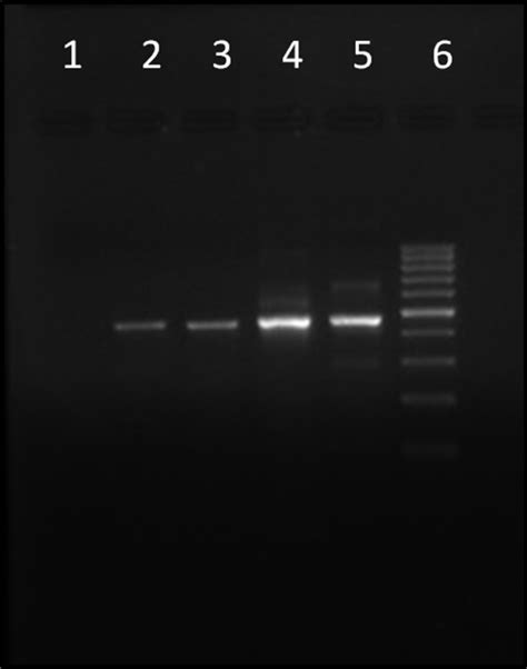 Representative Agarose Gel Electrophoresis Image Of The Amplified