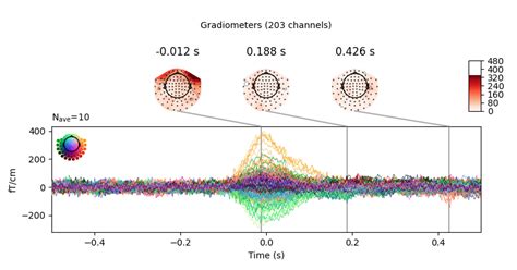 Overview Of Artifact Detection — Mne 1 1 1 Documentation