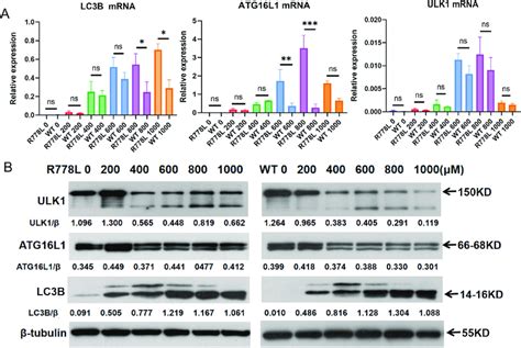 Atp7b R778l Mutant Hepg2 Cells Exhibit Higher Levels Of Autophagy Than