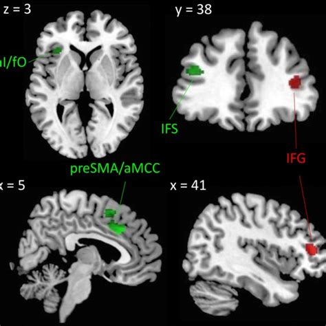 Convergence Of Brain Activation Across All Task Switching Experiments